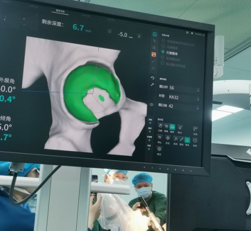 【医疗满意在人民】“利器”赋能，毫厘必争！泰安市中心医院成功完成机器人辅助DAA入路全髋关节置换术-泰安市中心医院